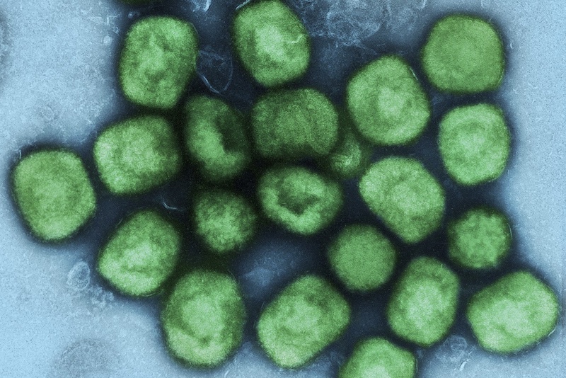 Monkeypox Infections Linked to LGBTQ Leather Event in Chicago