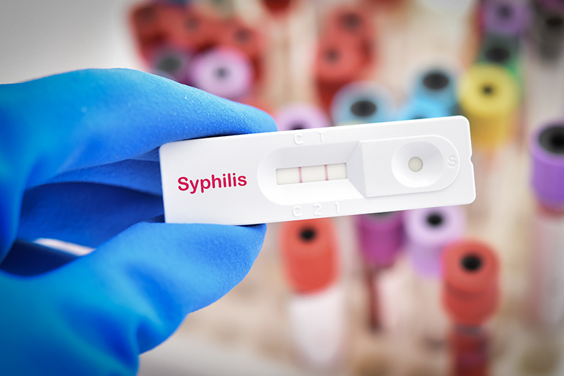Syphilis Test (Photo: Jarun011 via 123rf) - Metro Weekly